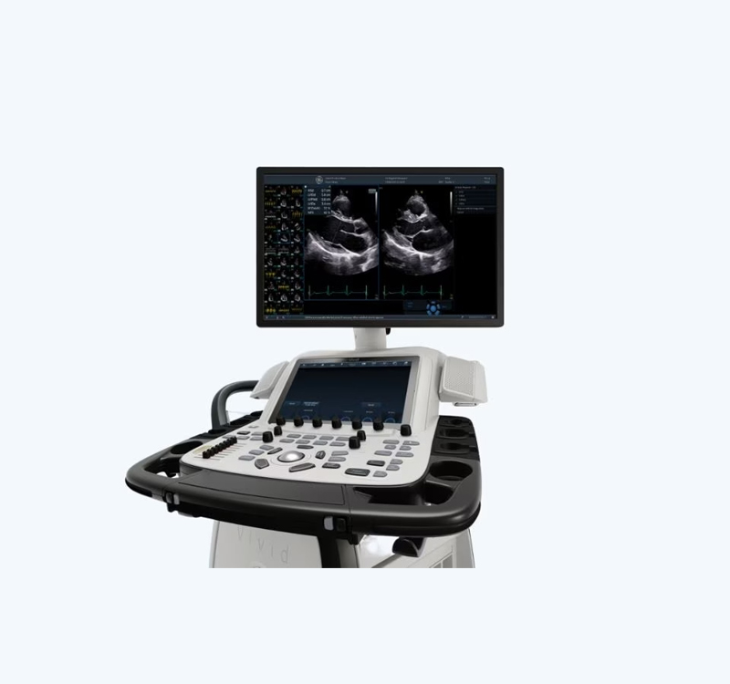 Vivid IQ POC - Radincon