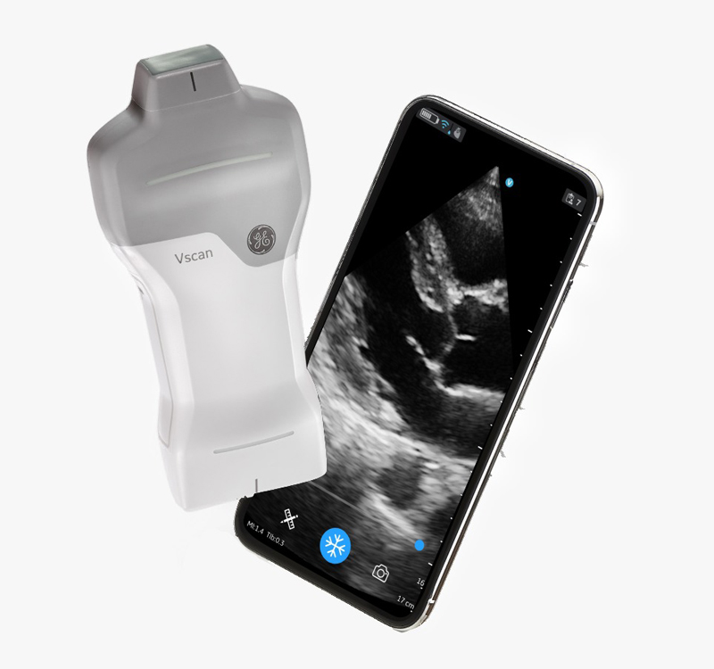 Vscan Air™ SL - Radincon