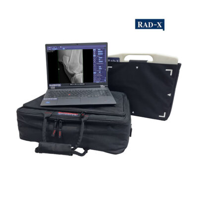 Portable DR Systems - Mobile Imaging Solutions from Radincon